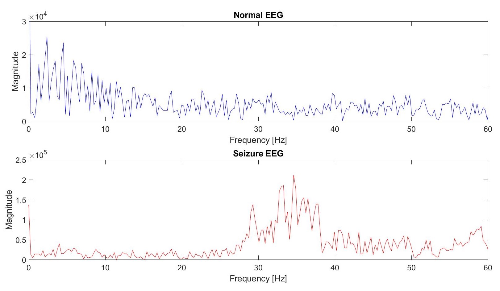 EEG Based Seizure Detection